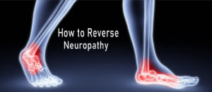 Reversing Neuropathy - Reverse Neuropathy NC